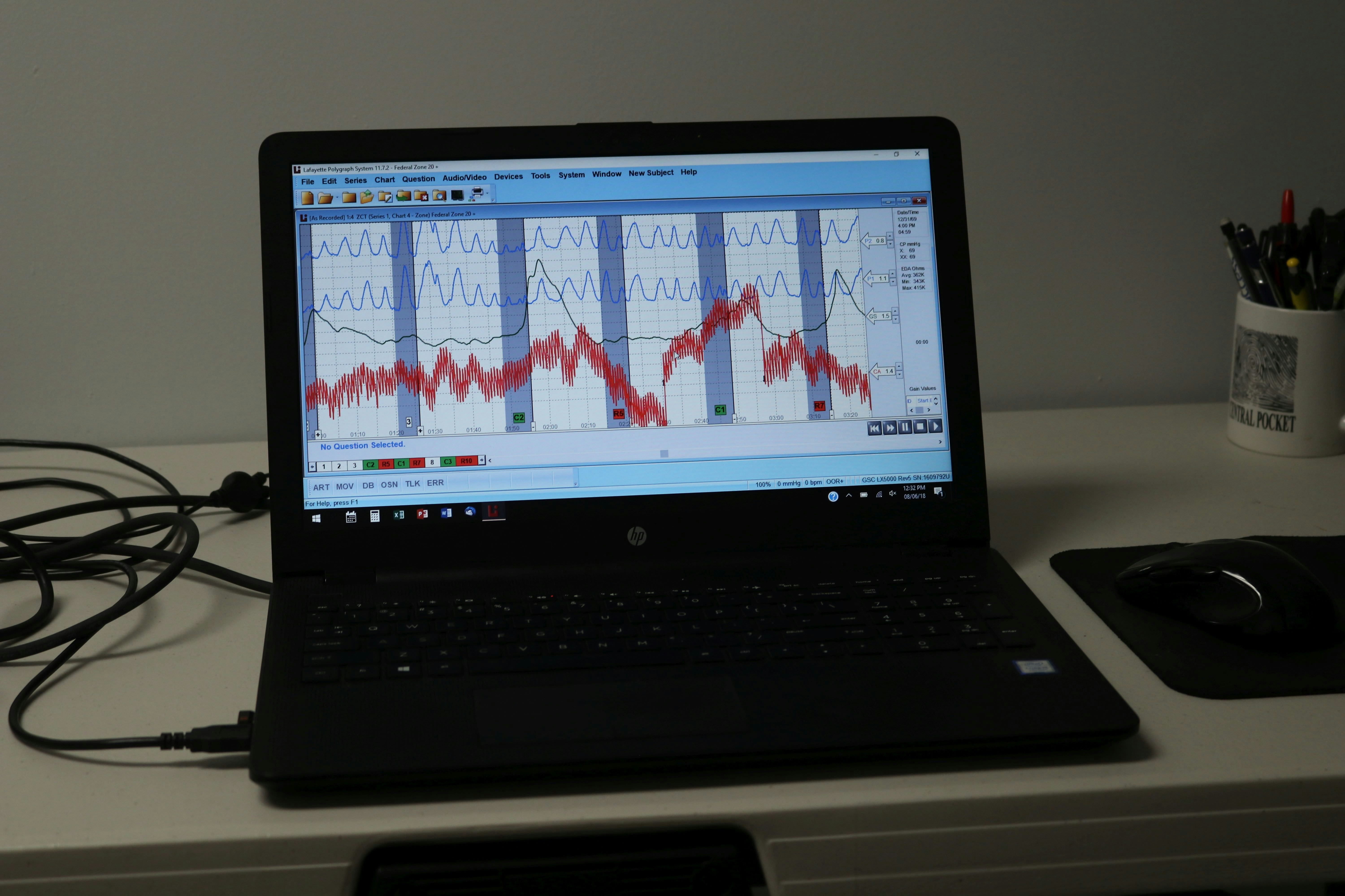 10 Things to Know About Polygraph Exams | Police Magazine